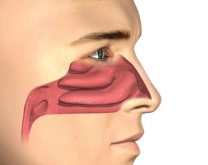 RhinAer® Procedure | Chronic Rhinitis Treatment Austin, TX